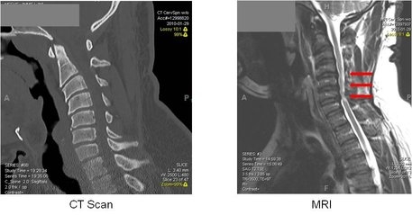Successful Surgery - Samuel K. Cho, MD
